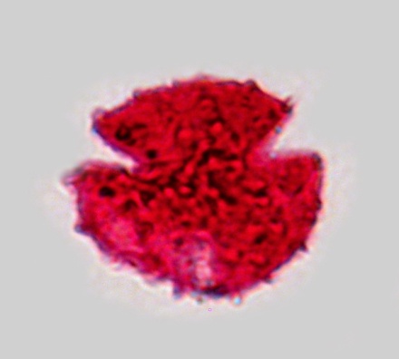 Colorado Earth Science: Fossil Pollen Reveals Florissant's Ice Age ...