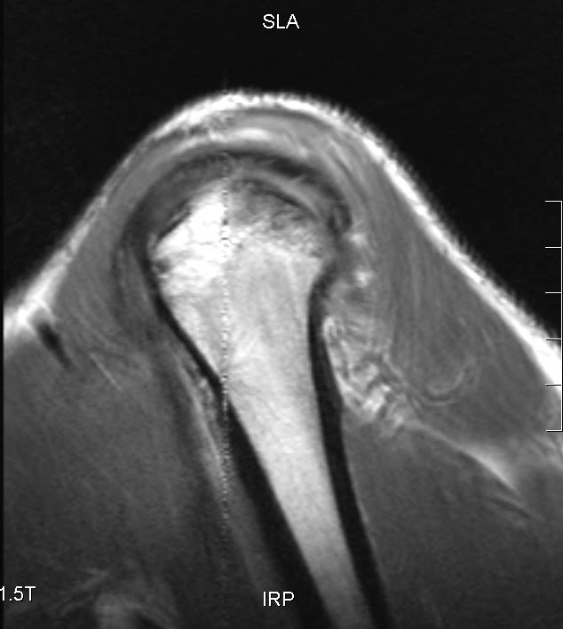 Heal Nerve and Muscular Atrophy: Healing Nerve and Muscular Atrophy ...