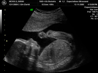 The Nichols Family: 3d/4d Ultrasound 22 Weeks!