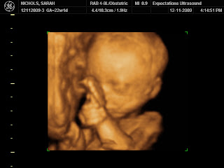 The Nichols Family: 3d/4d Ultrasound 22 Weeks!
