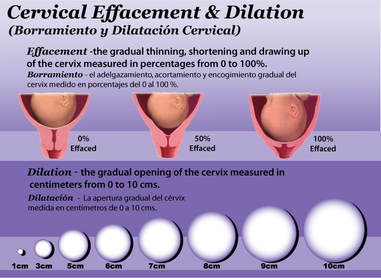 The Little Blueberry 3 Cm Dilated And 80 Effaced 