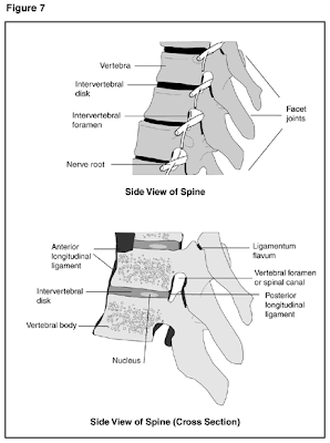 Lumbar Spine: Thecal Sac Lumbar Spine