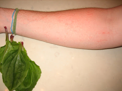 Have You Ever Picked A Carrot?: Rash, Blister, Bug Bite/Sting, Open ...