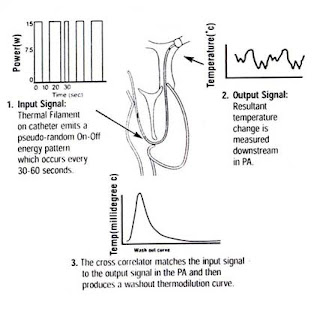 Anaesthesiology at Narayana Hrudayalaya
