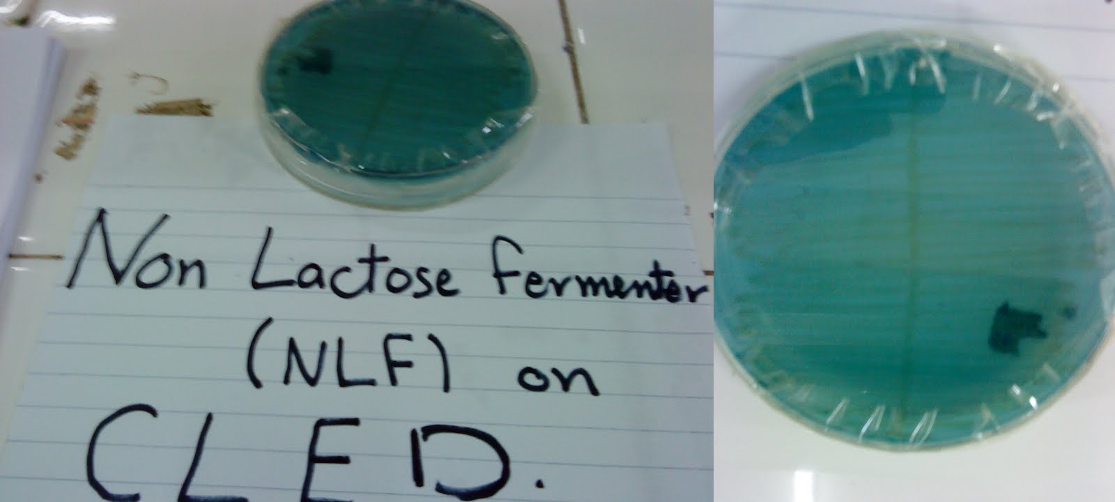 c.E.r.i.T.e.T.e.N.t.A.n.G.k.i.T.e.: Culture Media...