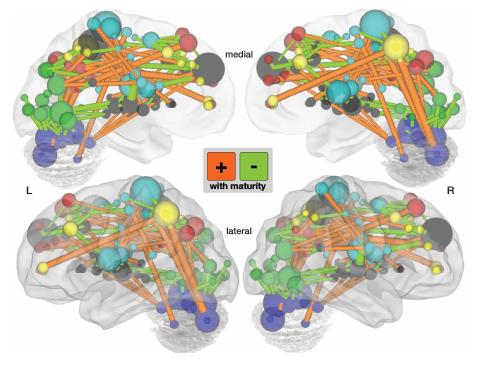 Neurology Center: You're (Brain Is) So Immature