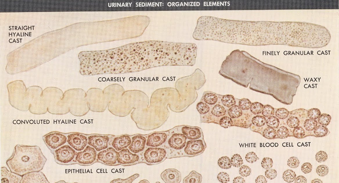 Ripani Musyaffa Ahdanlab Blog: SEDIMEN STERNHEIMER MALBIN STAIN