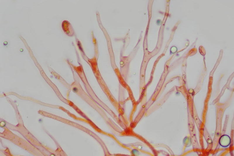 El mundo microscópico de los hongos: Basidiomicetos