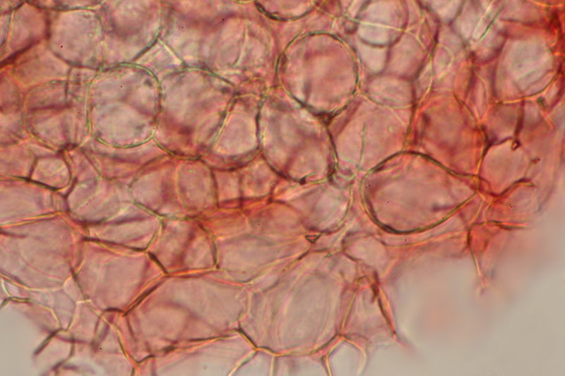 El mundo microscópico de los hongos: Gasteromicetos